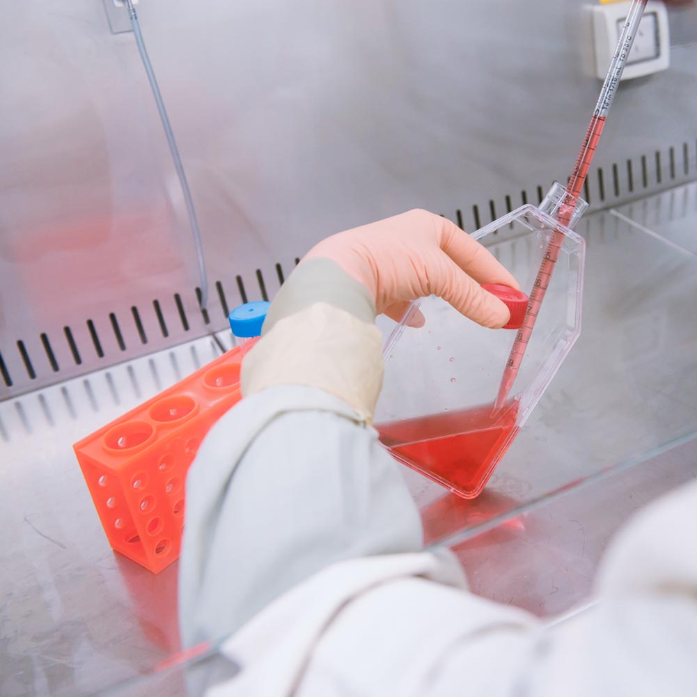Clinical Trial Support | Cell Therapies